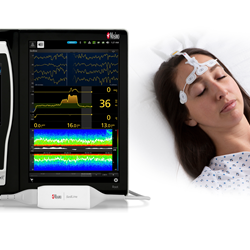 Masimo - New Study Evaluates the Ability of Masimo SedLine® Brain ...